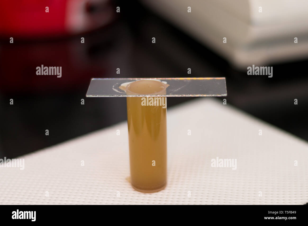 Esame coproparazitologico immagini e fotografie stock ad alta ...