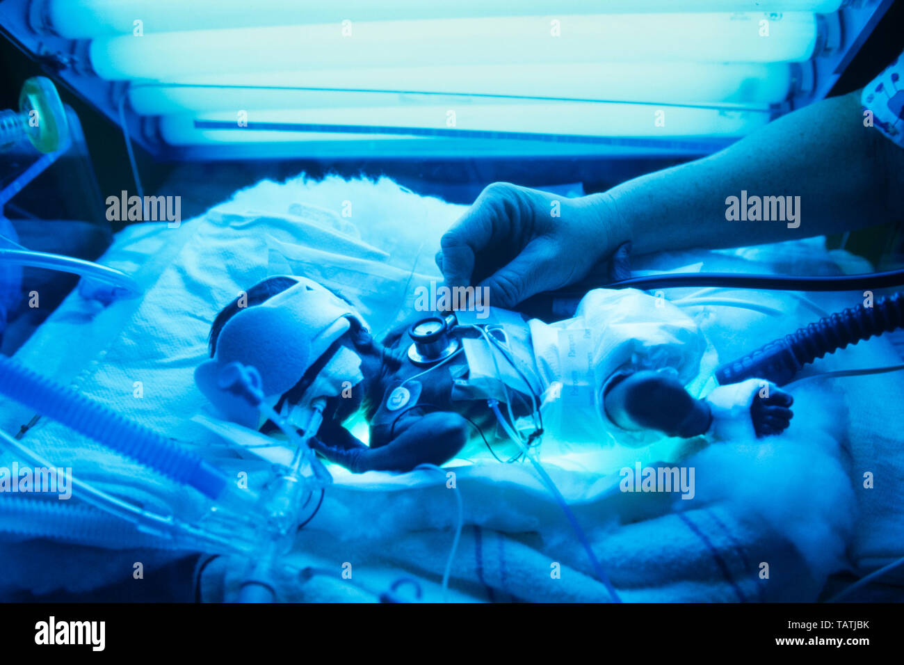 Terapia intensiva neonatale immagini e fotografie stock ad alta ...