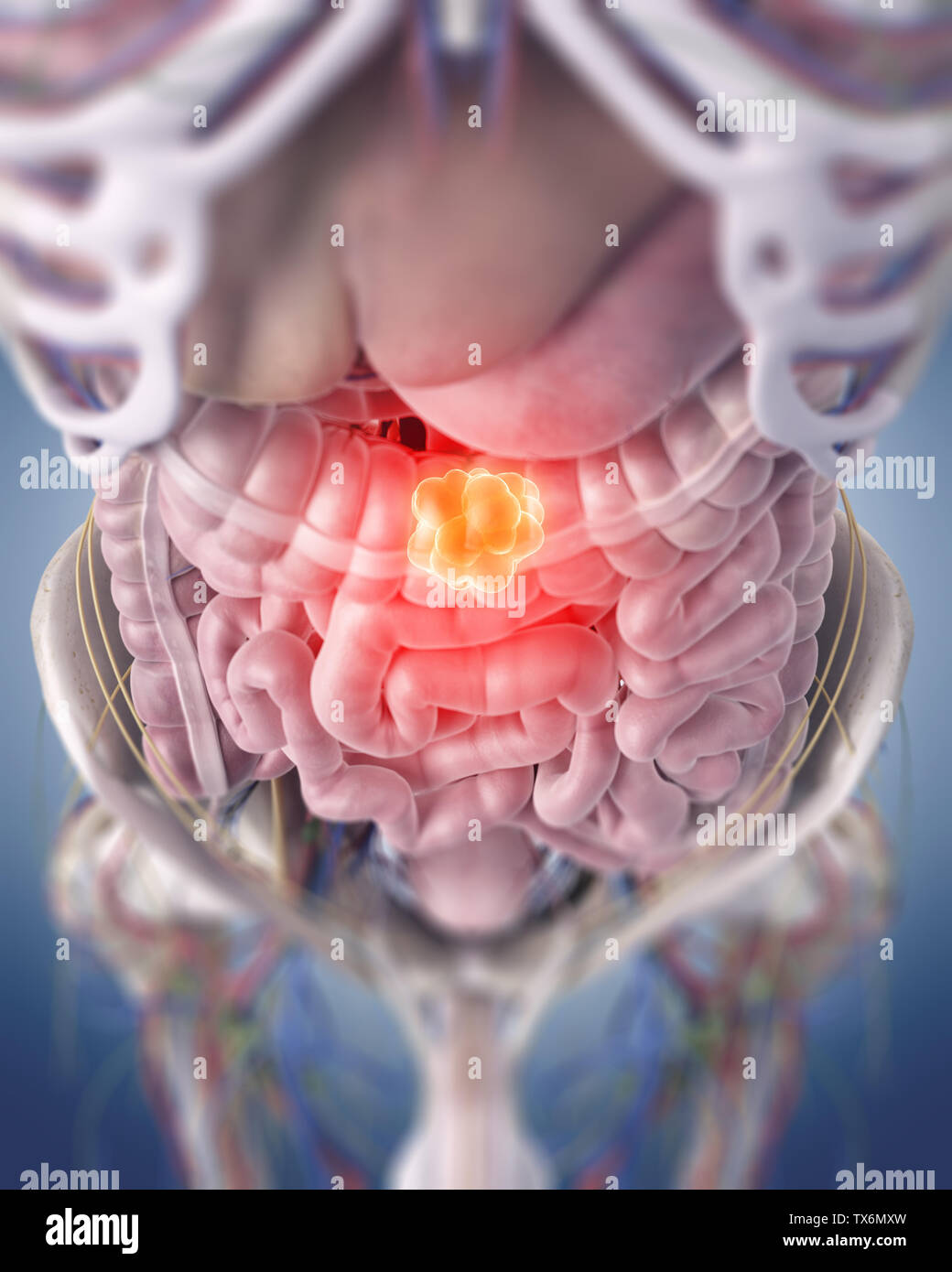 Colon pelvico immagini e fotografie stock ad alta risoluzione - Alamy