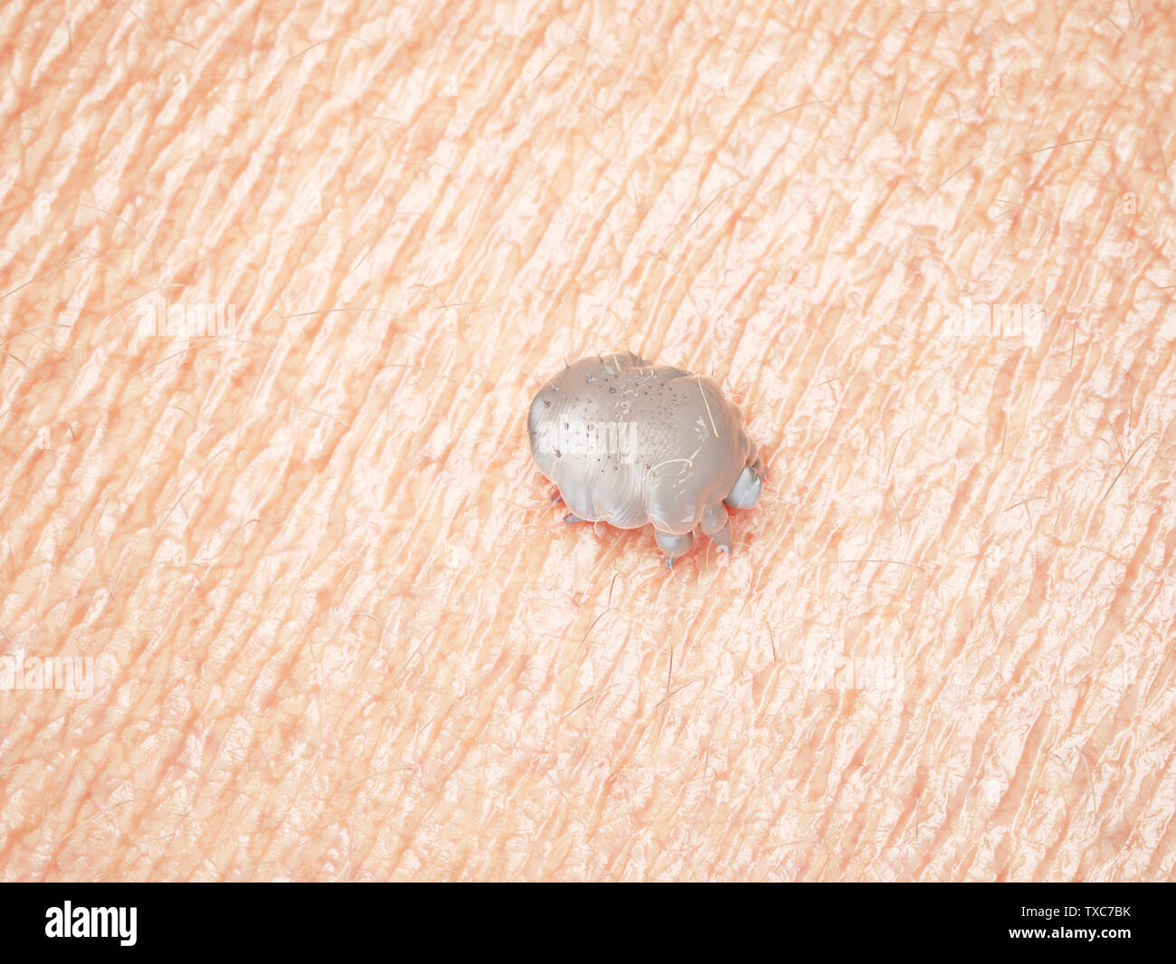 Acari della scabbia sarcoptes scabiei immagini e fotografie stock ad ...