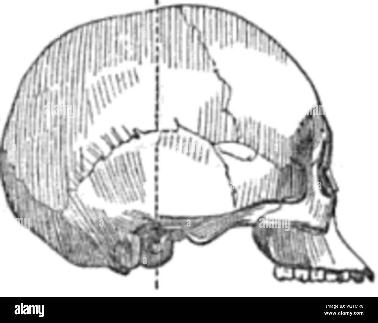 Caratteristiche mongoloidi immagini e fotografie stock ad alta ...