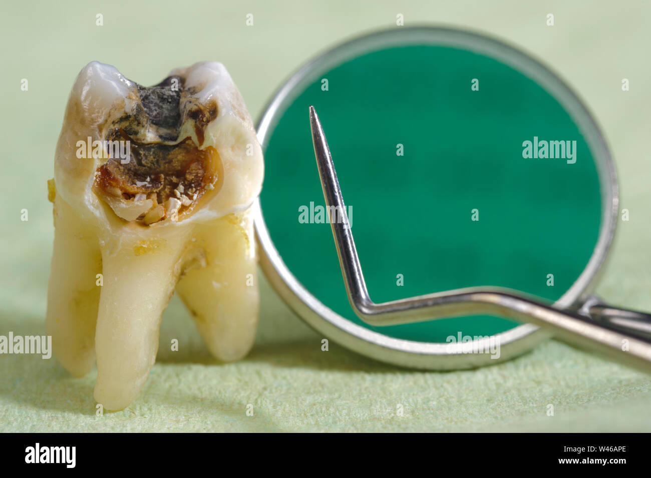 Denti marci estratti immagini e fotografie stock ad alta risoluzione ...