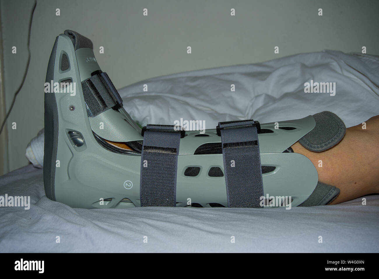 Tendini del piede immagini e fotografie stock ad alta risoluzione - Alamy
