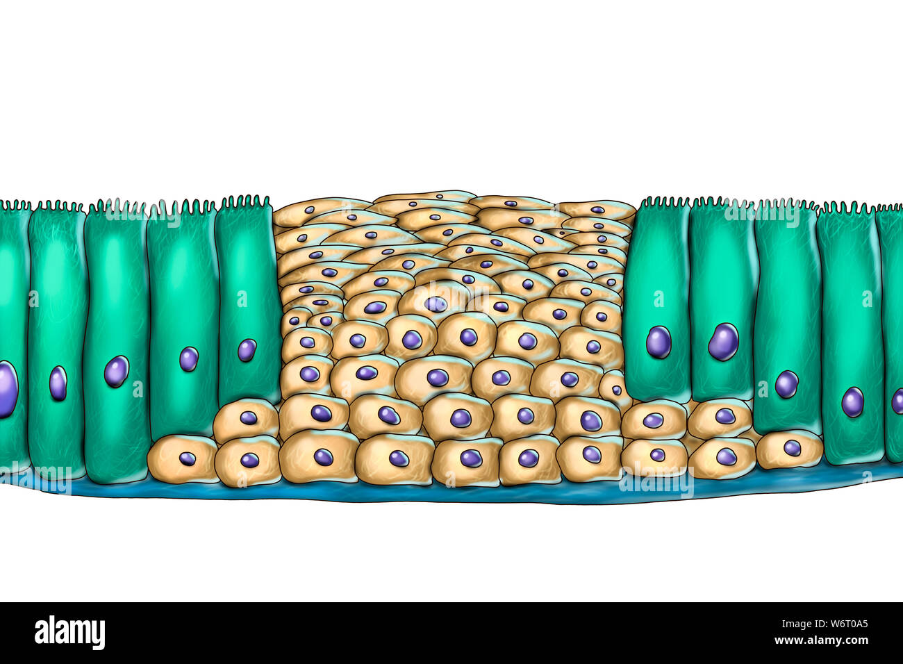 La metaplasia epiteliale, illustrazione del computer. La metaplasia è ...