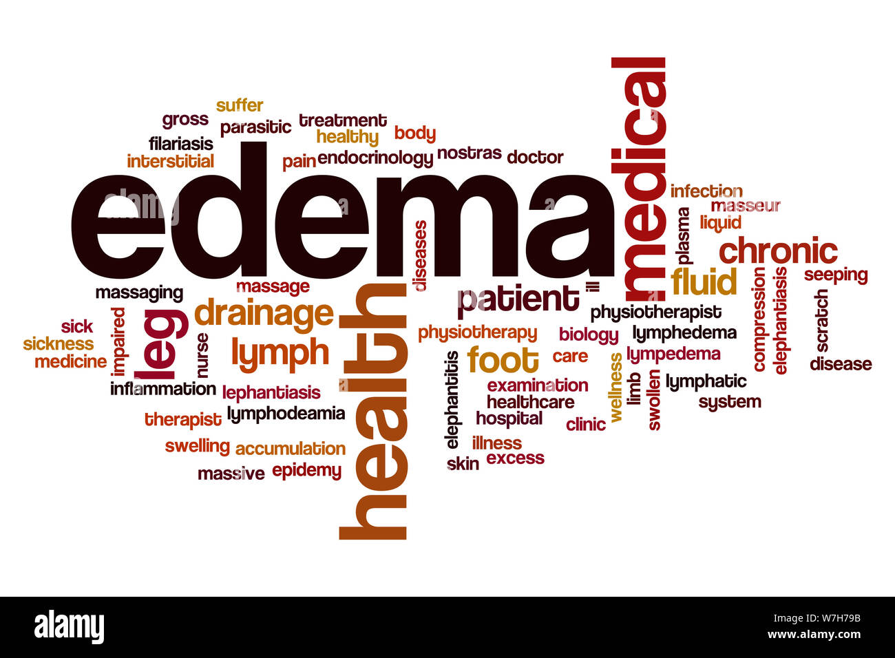 Lymphedema disease immagini e fotografie stock ad alta risoluzione - Alamy