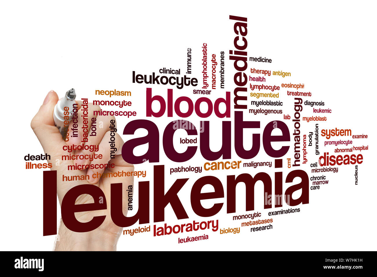 Leucemia mieloide acuta microscopio immagini e fotografie stock ad alta ...