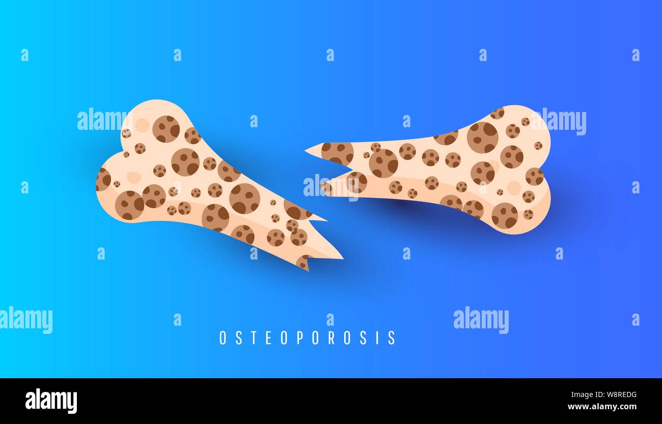 Osso compatto Immagini Vettoriali Stock - Alamy