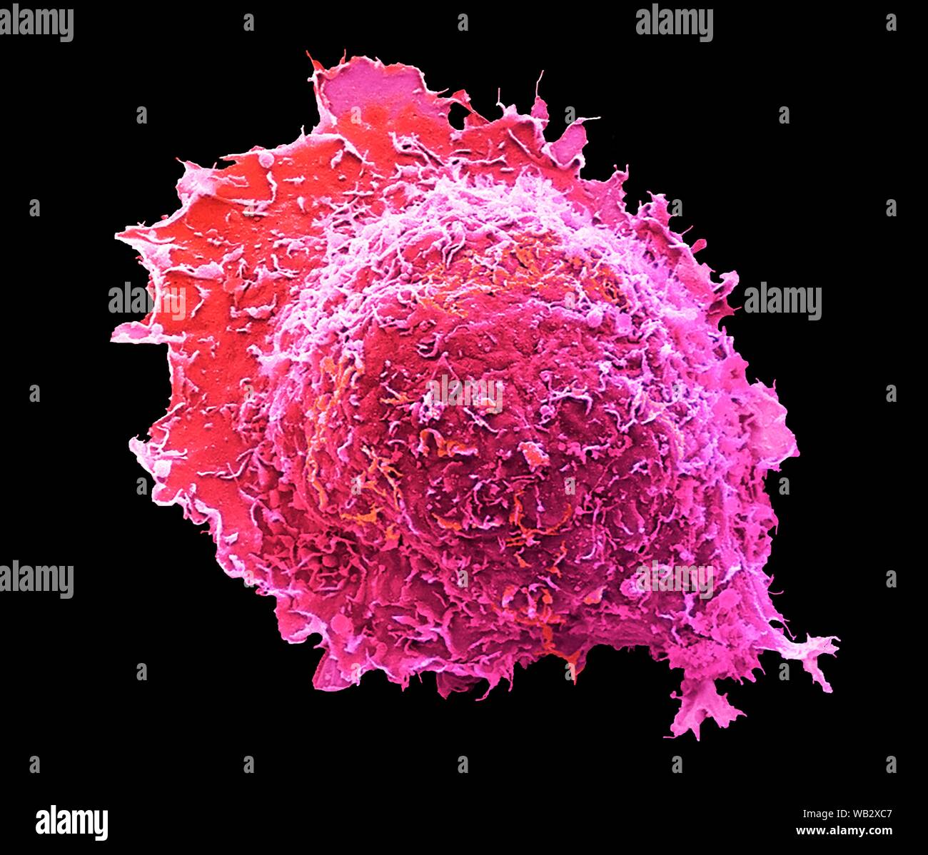 Osteoblasto cellula ossea. Color scanning electron microfotografia (SEM ...