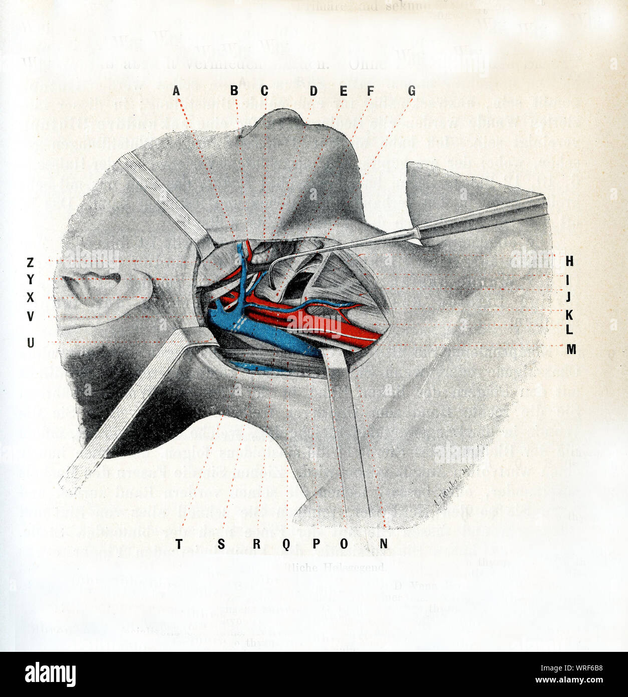 Arteria carotidea immagini e fotografie stock ad alta risoluzione - Alamy