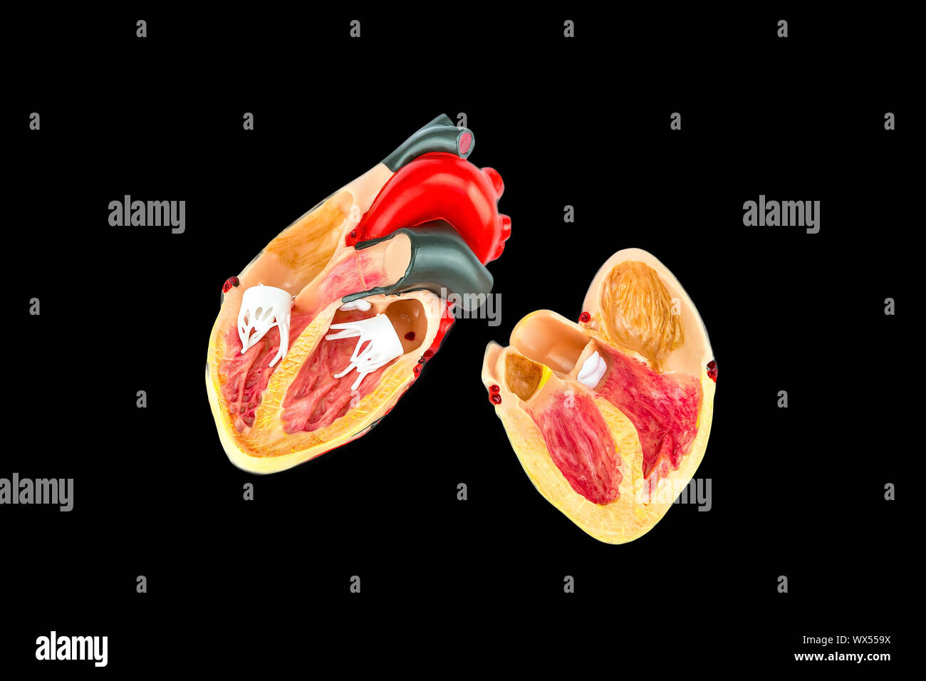 Modello Cardiaco Del Solco Coronarico